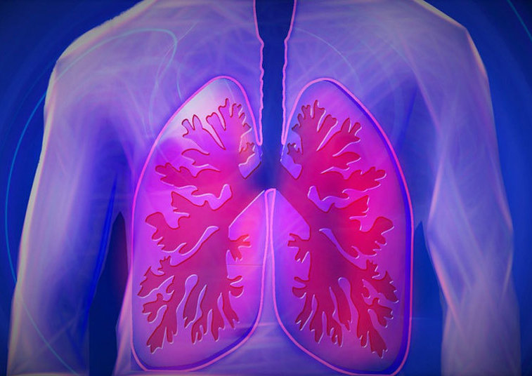 Artificial Intelligence Can Help Detect Lung Cancer Even In The Early